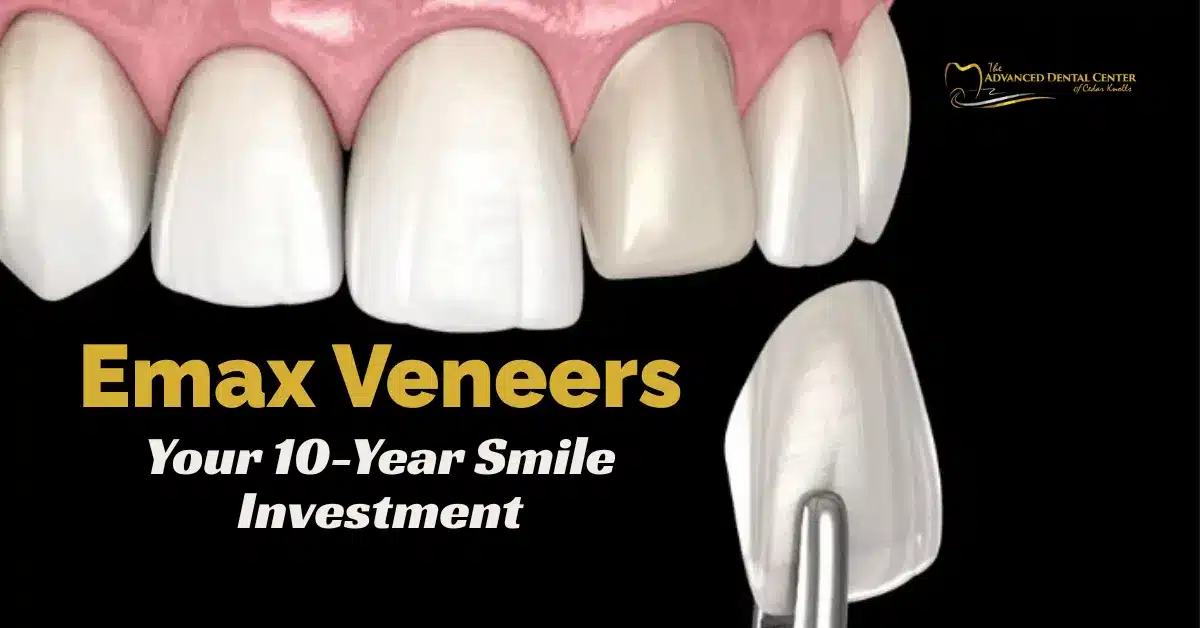 Emax Veneers Guide for Patients in Cedar Knolls, NJ