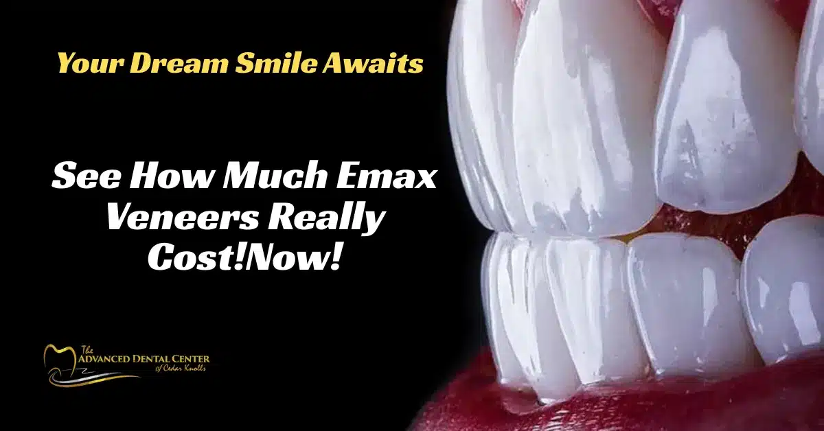 Cost of Emax Veneers in Cedar Knolls, NJ | 2025 Guide
